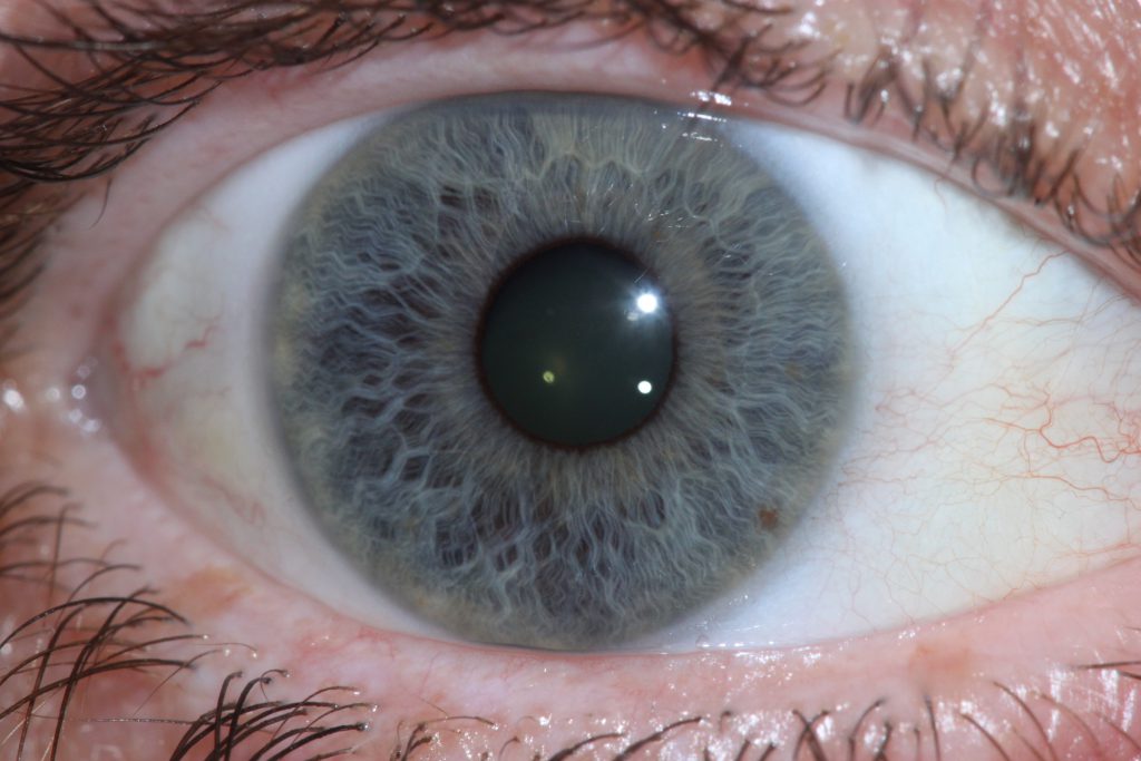 What is Iridology? | Papillonic Health